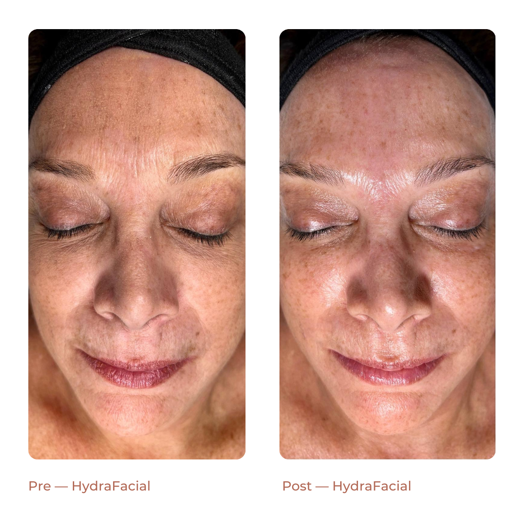 $50 off Facials at Elase